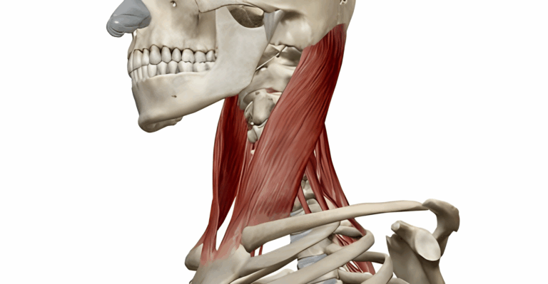Sternocleidomastoid Syndrome: Neck Pain Relief | MVM Health