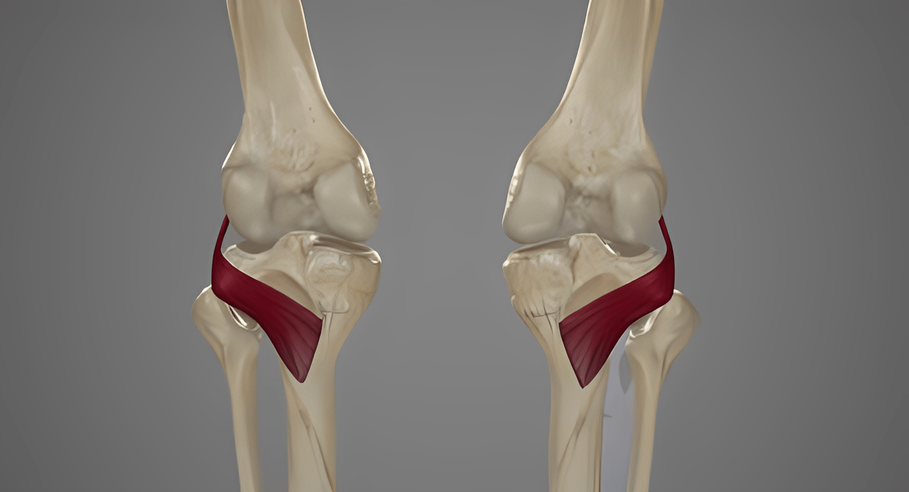Strengthening the Popliteus for Knee Osteoarthritis Pain Relief